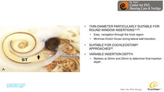 Cochlear implant systems | PPTX