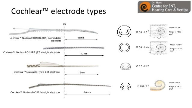 Cochlear implant systems