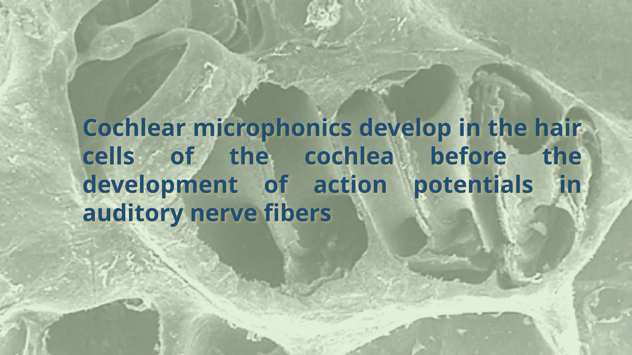 Cochlear Microphonics, a seminar for MD students | PPTX