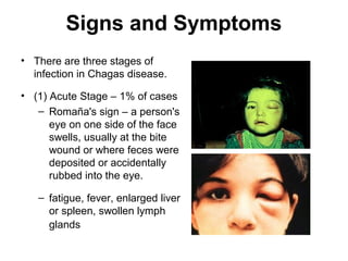 Cockroaches and disease | PPT