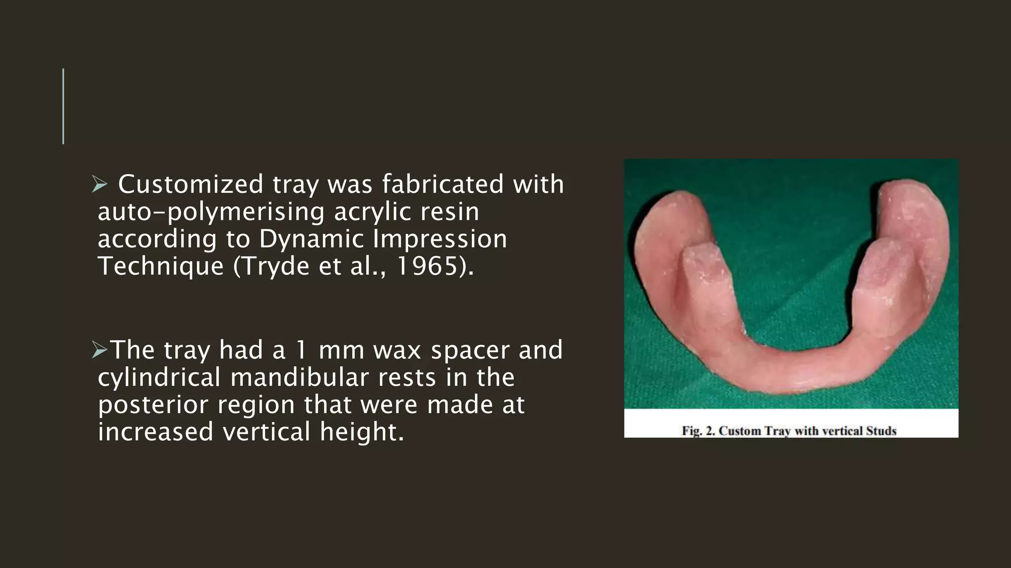 Cocktail impression technique | PPTX