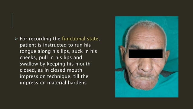 Cocktail impression technique | PPTX