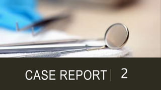 Cocktail impression technique | PPTX