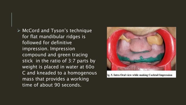 Cocktail impression technique | PPTX