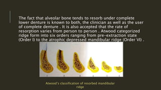 Cocktail impression technique | PPTX