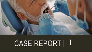 Cocktail impression technique | PPTX