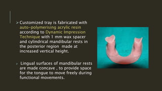 Cocktail impression technique | PPTX