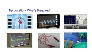 Vascular Access Part 1: Reducing risk and increasing catheter longevity ...