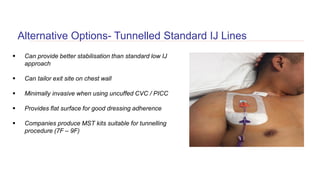 Vascular Access Part 1: Reducing risk and increasing catheter longevity ...