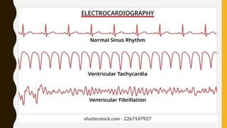 code blue dan prinsip code blue gawat darurat | PPTX