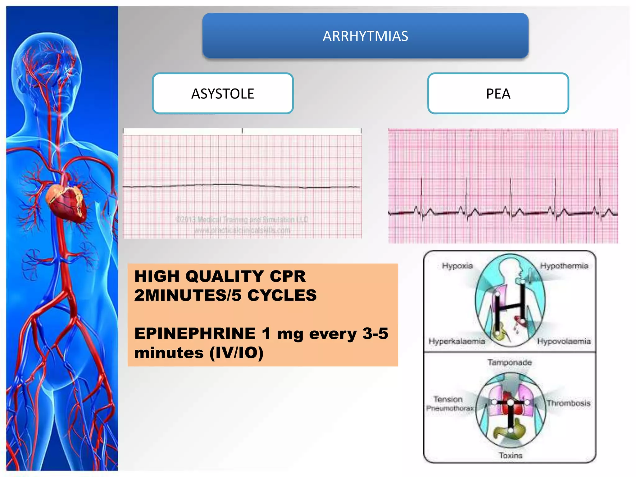 Code blue management | PPTX