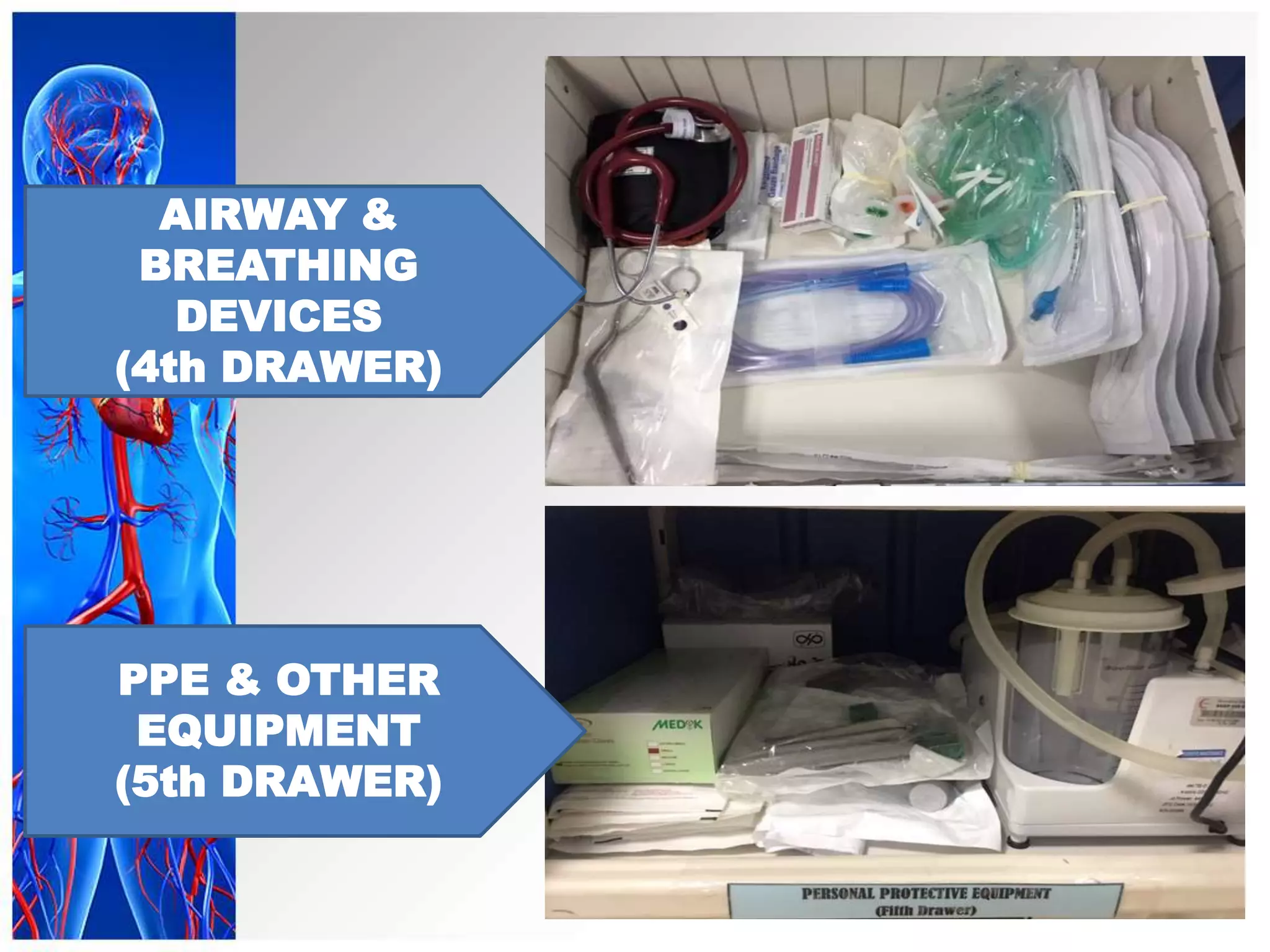 Code blue management | PPTX