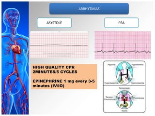 Code blue management | PPTX