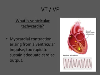 Code Management: VT & VF | PPT