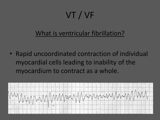 Code Management: VT & VF | PPT