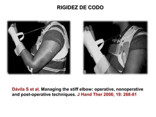 Codo | PPT