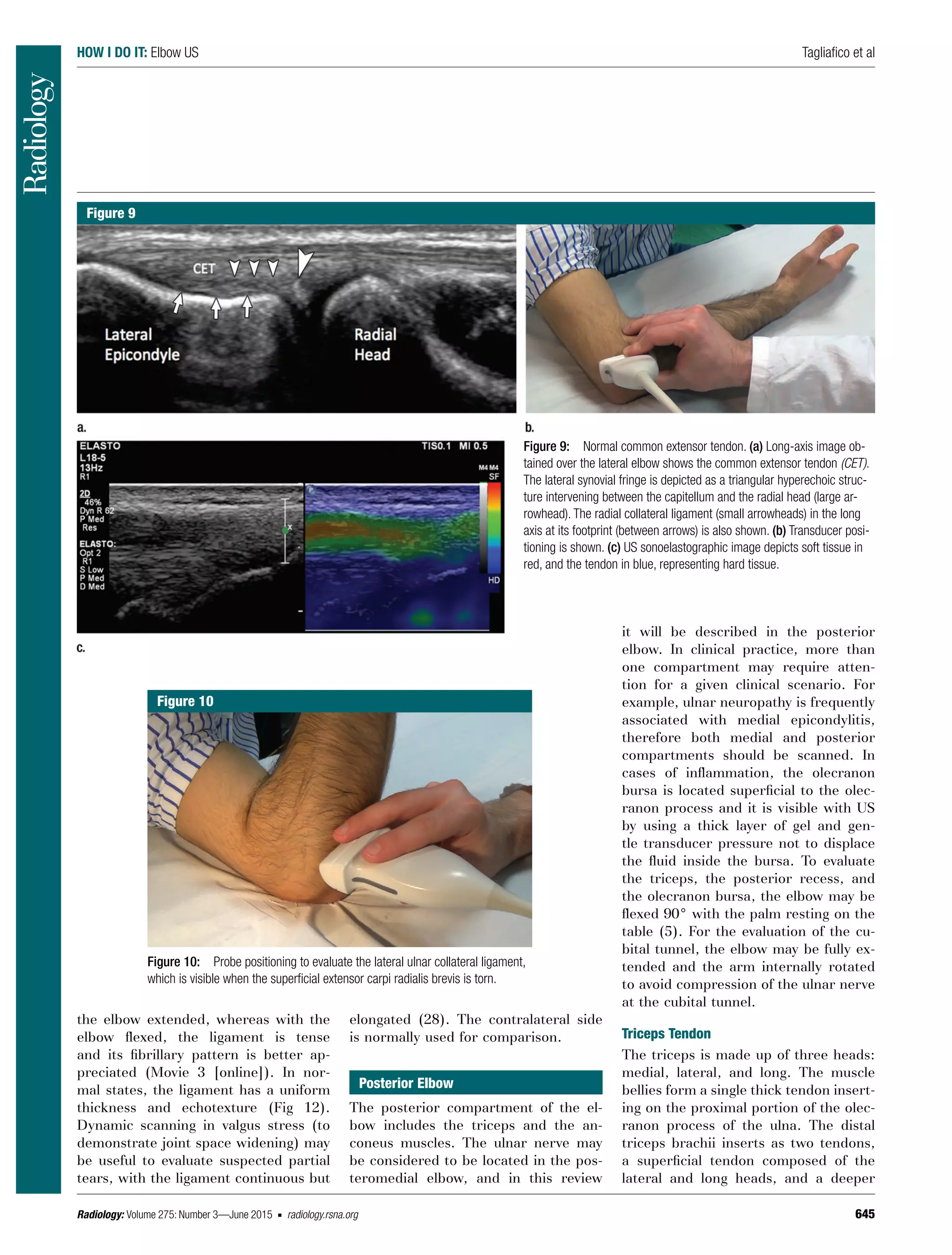 Codo 1. elbow us anatomy, variants, and scanning technique | PDF
