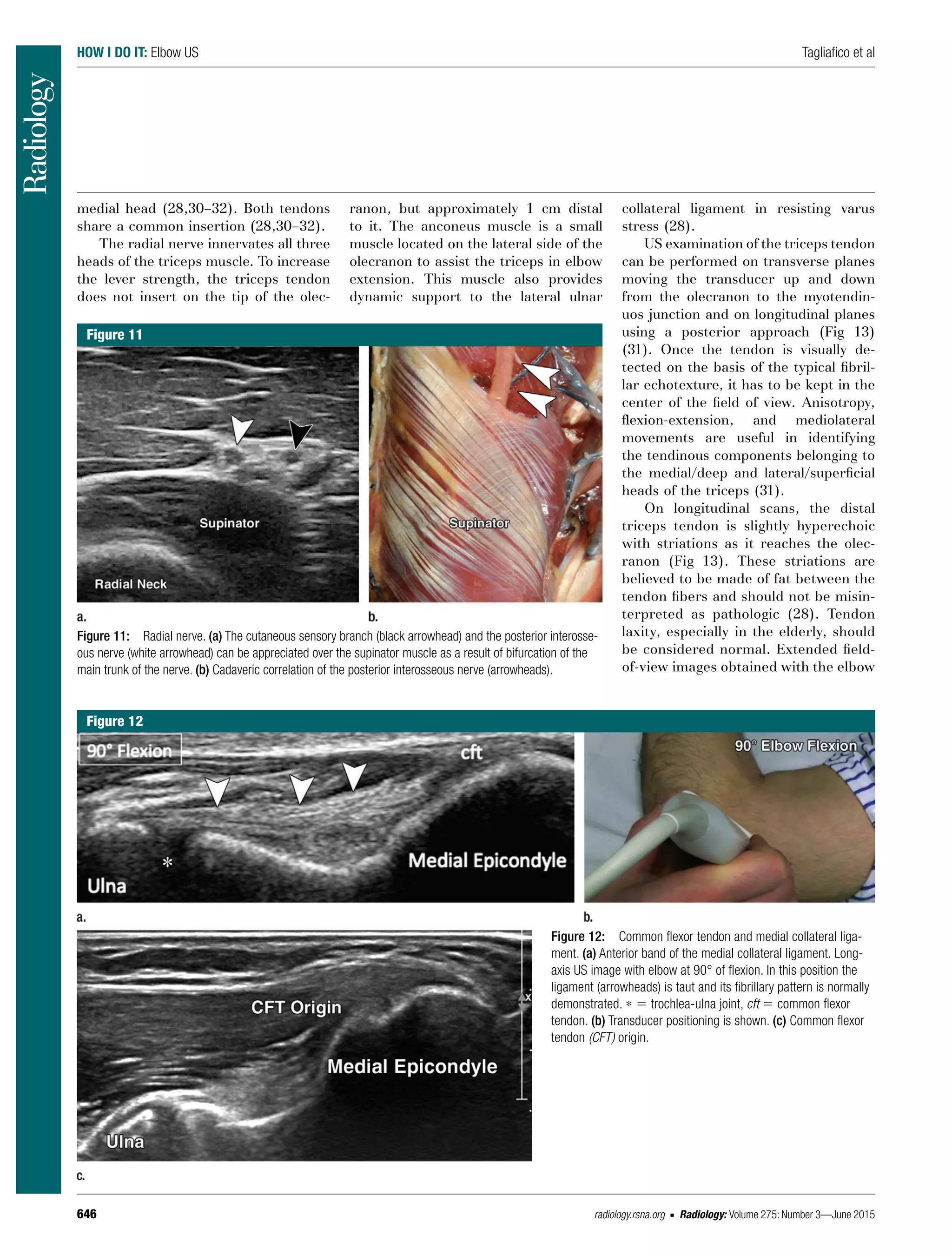 Codo 1. elbow us anatomy, variants, and scanning technique | PDF