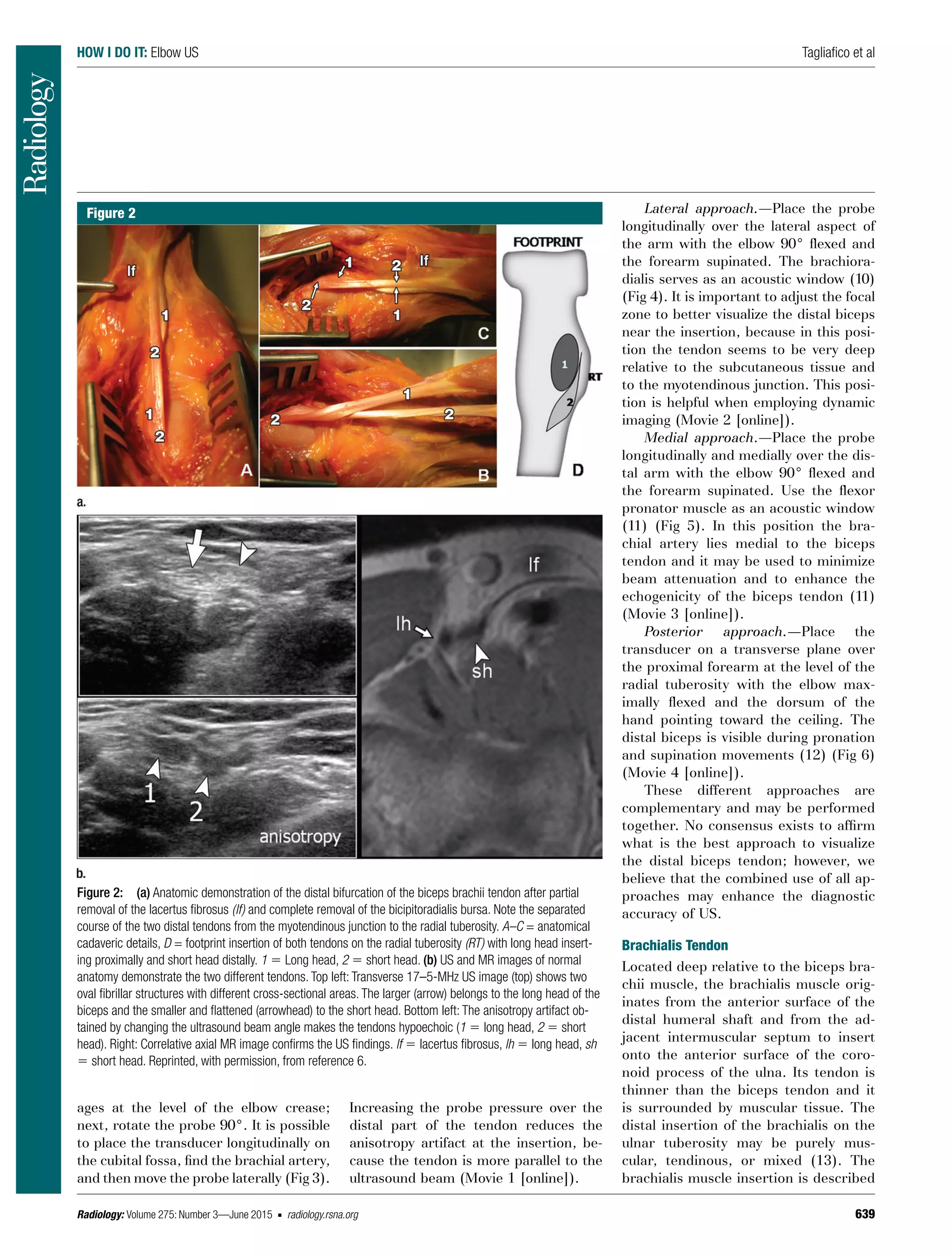 Codo 1. elbow us anatomy, variants, and scanning technique | PDF