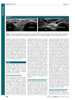 Codo 1. elbow us anatomy, variants, and scanning technique | PDF ...
