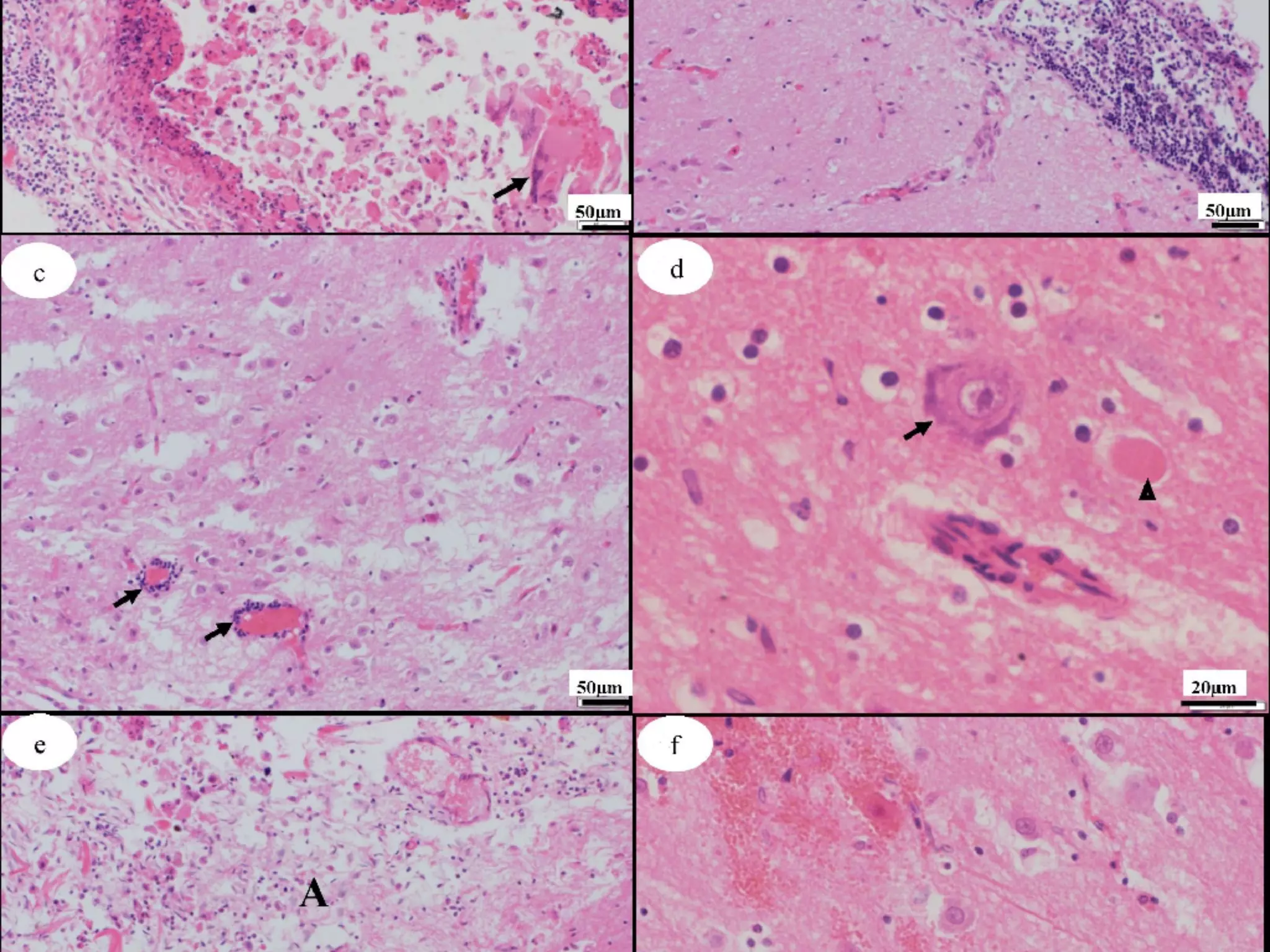Coenurus cerebralis | PDF