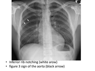 Cogenital heart ds. | PPTX
