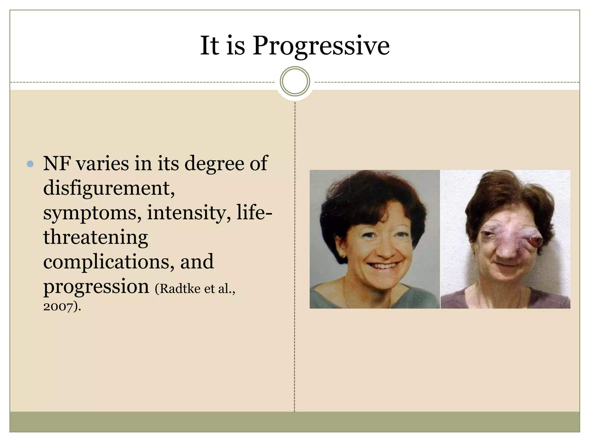 Cognitive Impairment In Children With Type 1 Neurofibromatosis | PPTX