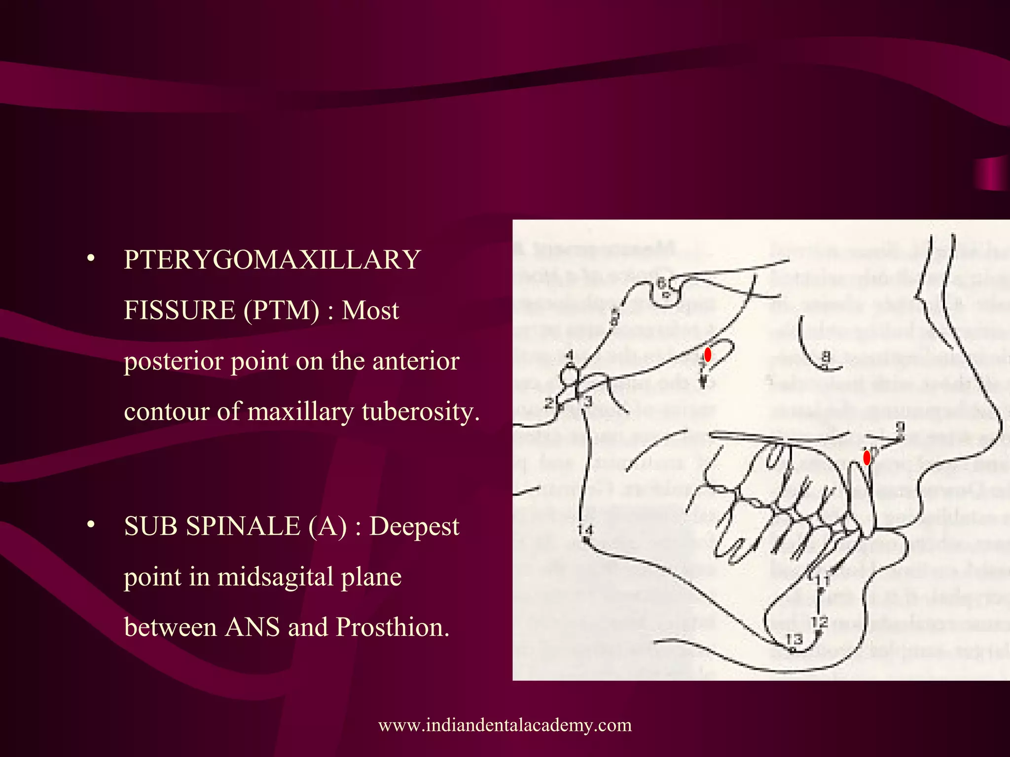 COGS analysis (Cephelometrics for orthognathic surgery) / fixed ...