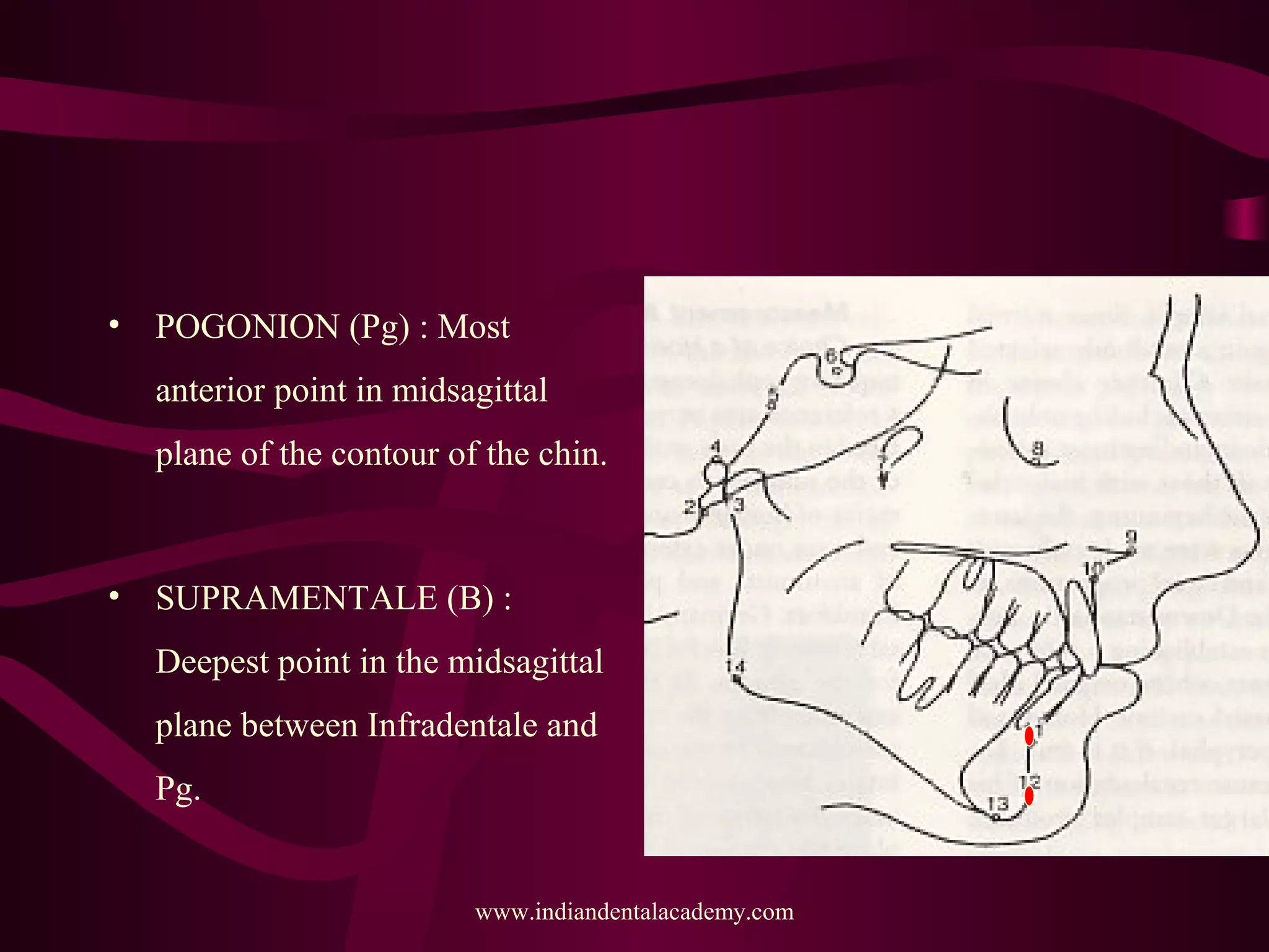 COGS analysis (Cephelometrics for orthognathic surgery) / fixed ...