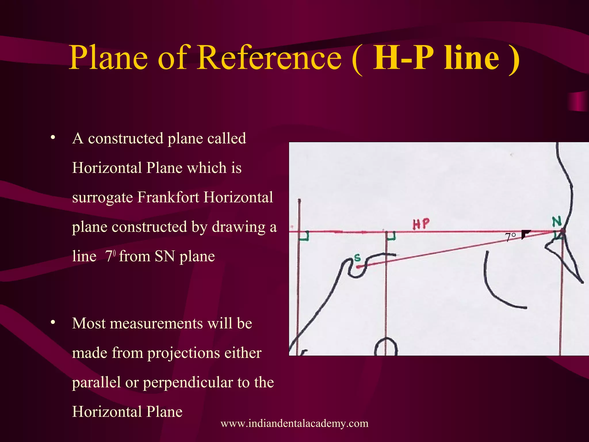 COGS analysis (Cephelometrics for orthognathic surgery) / fixed ...