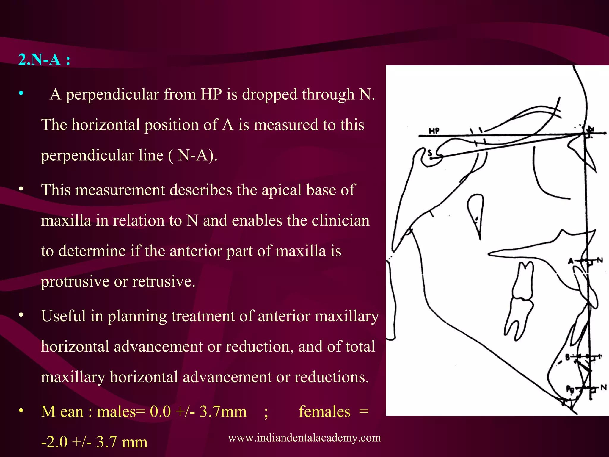COGS analysis (Cephelometrics for orthognathic surgery) / fixed ...