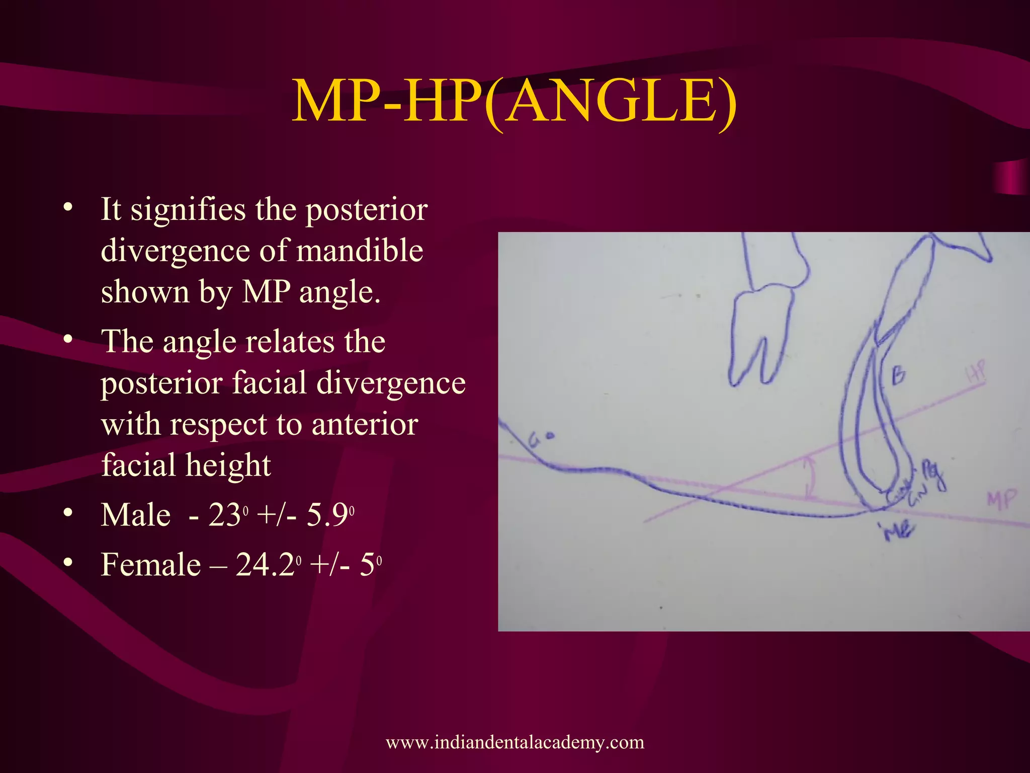COGS analysis (Cephelometrics for orthognathic surgery) / fixed ...