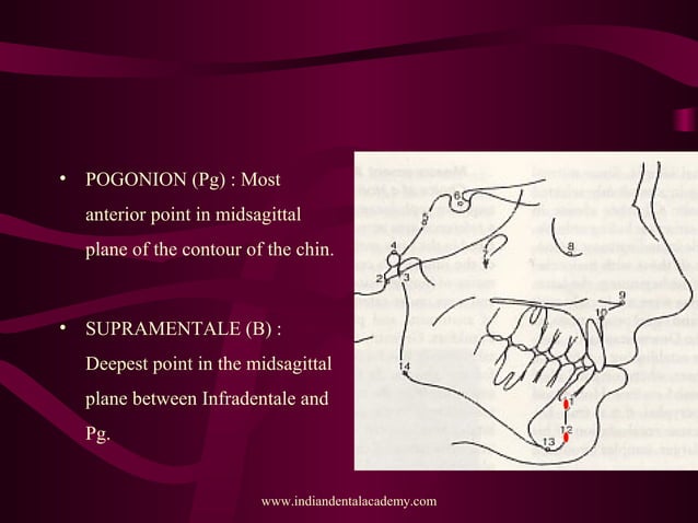COGS analysis (Cephelometrics for orthognathic surgery) / fixed ...