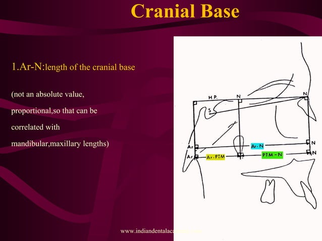 COGS analysis (Cephelometrics for orthognathic surgery) / fixed ...