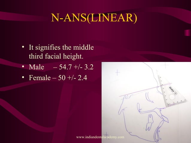 COGS analysis (Cephelometrics for orthognathic surgery) / fixed ...