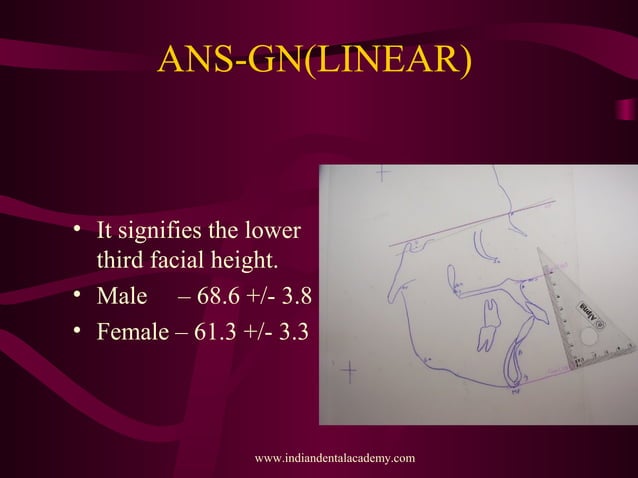 COGS analysis (Cephelometrics for orthognathic surgery) / fixed ...