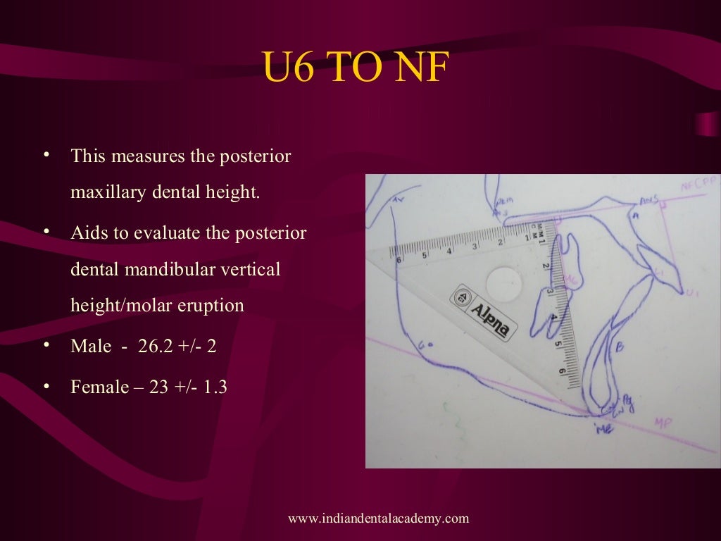 COGS analysis (Cephelometrics for orthognathic surgery) / fixed ortho…