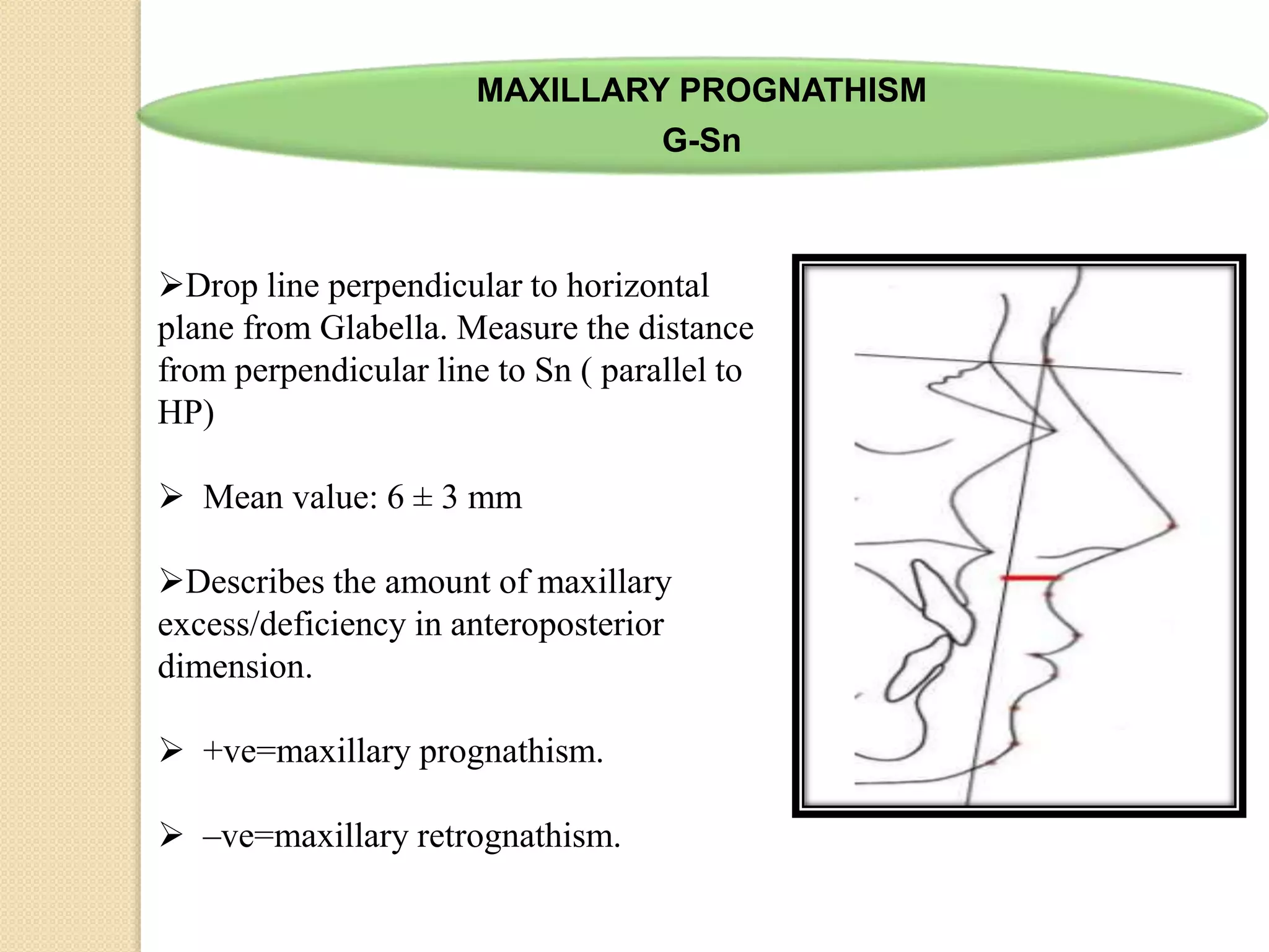 BURSTONE ANALYSIS : C.O.G.S (SOFT TISSUE) | PPTX