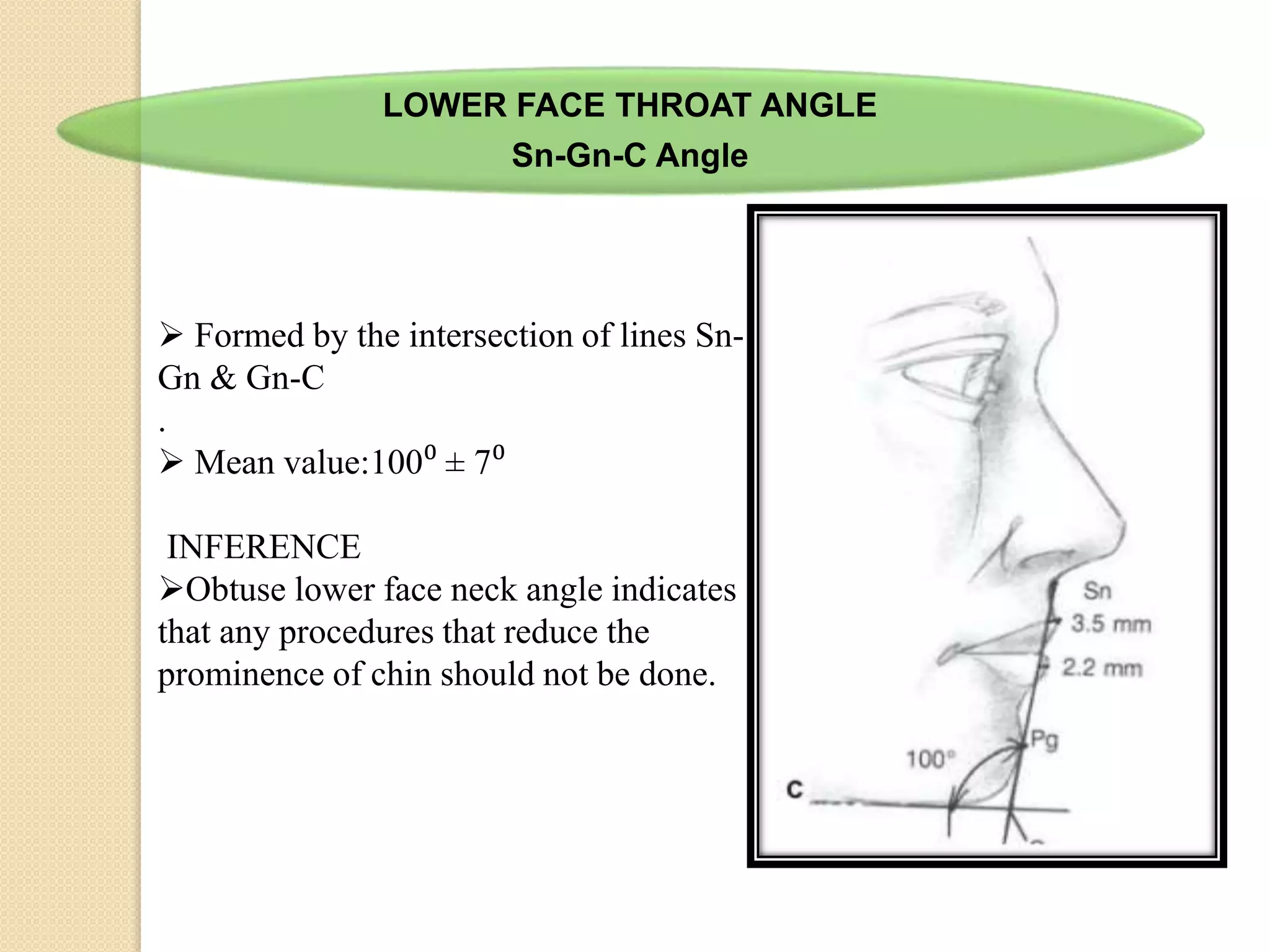 BURSTONE ANALYSIS : C.O.G.S (SOFT TISSUE) | PPTX