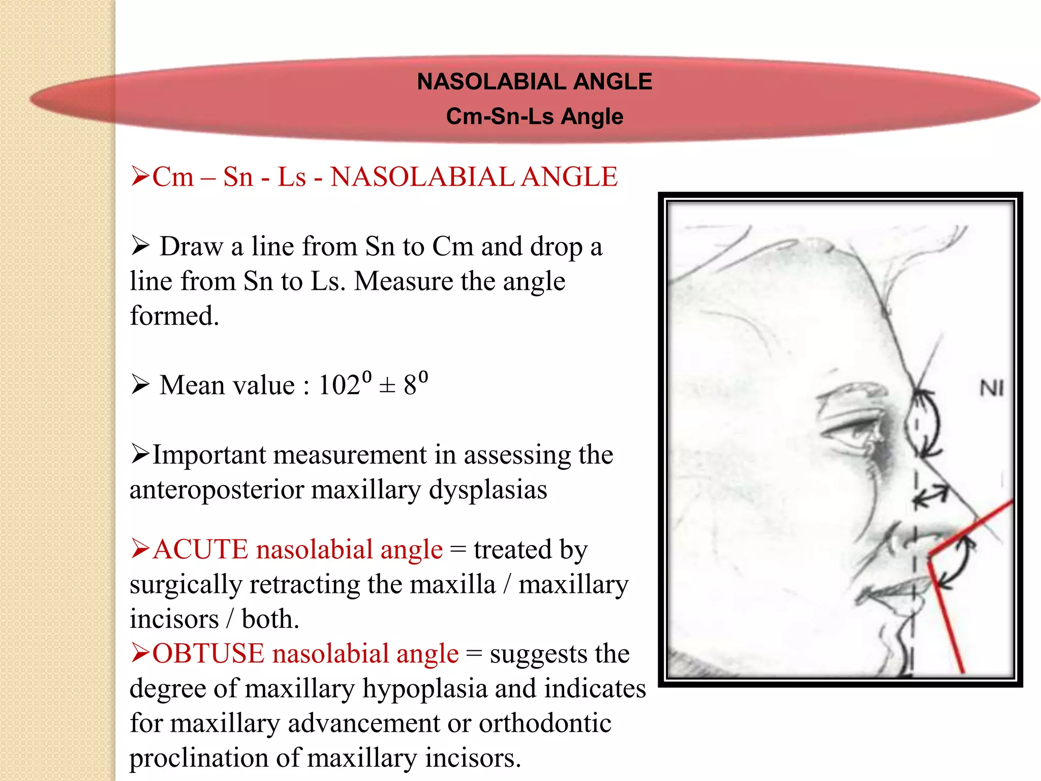 BURSTONE ANALYSIS : C.O.G.S (SOFT TISSUE) | PPTX