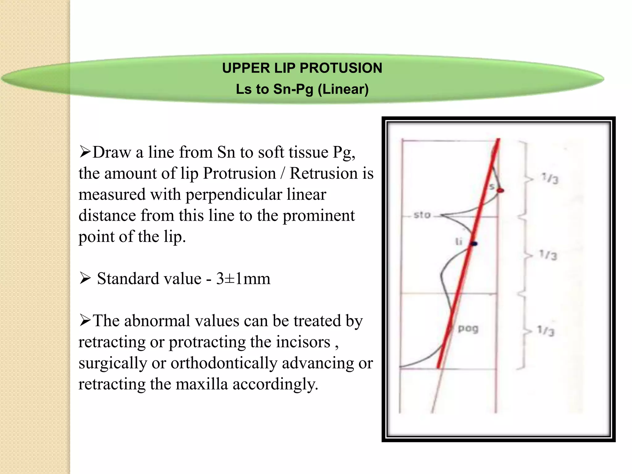 BURSTONE ANALYSIS : C.O.G.S (SOFT TISSUE) | PPTX