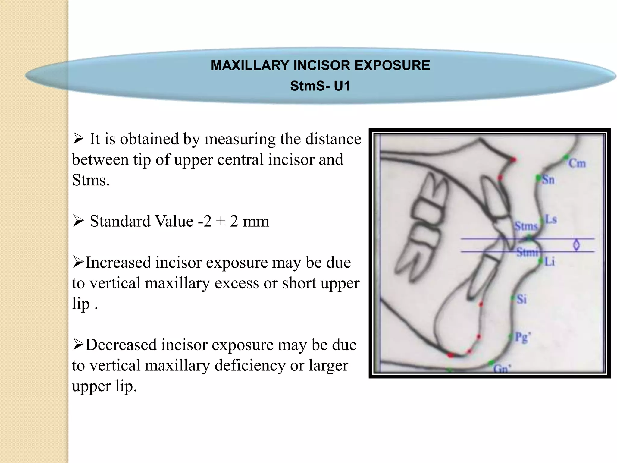 BURSTONE ANALYSIS : C.O.G.S (SOFT TISSUE) | PPTX