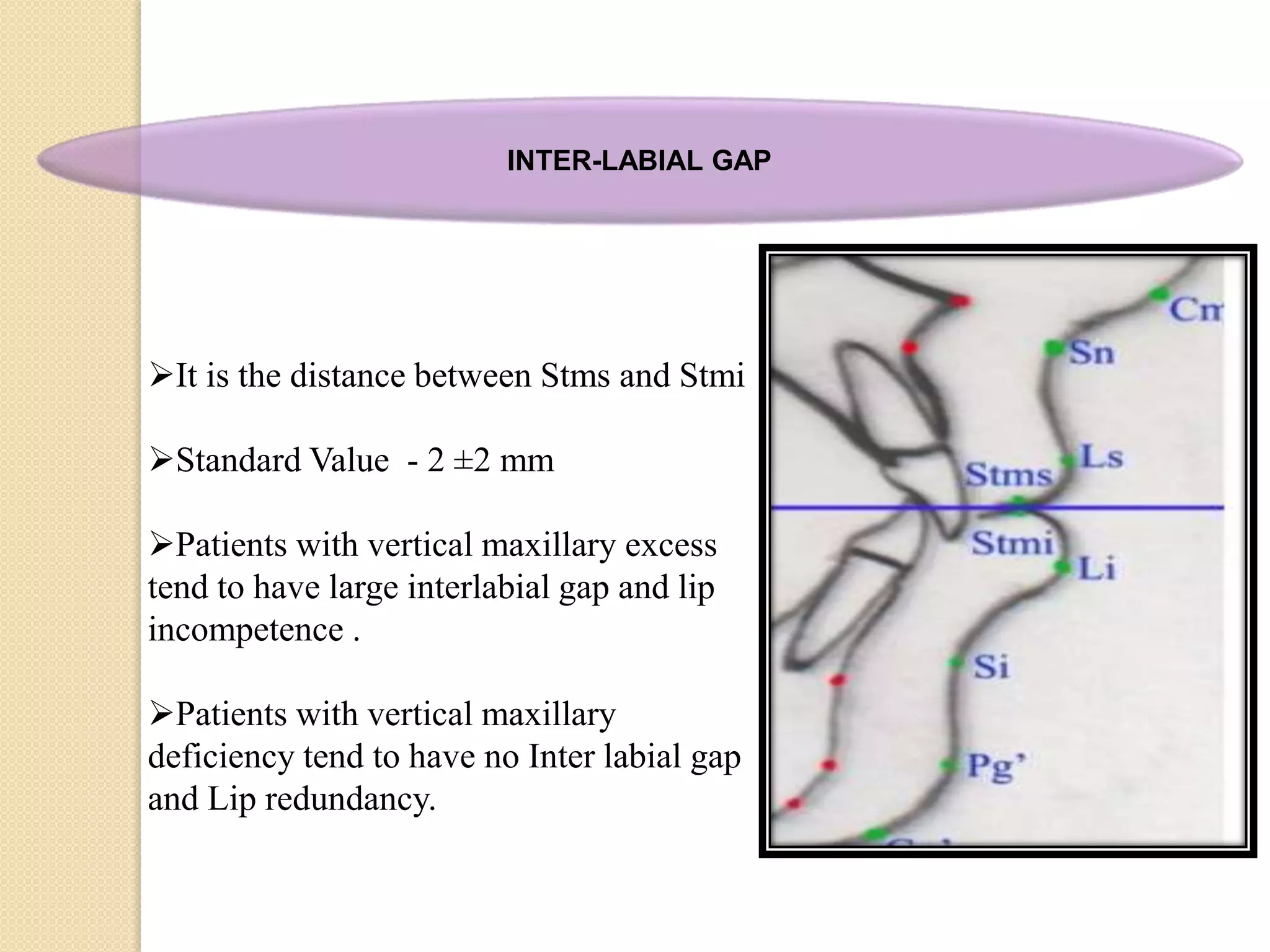BURSTONE ANALYSIS : C.O.G.S (SOFT TISSUE) | PPTX