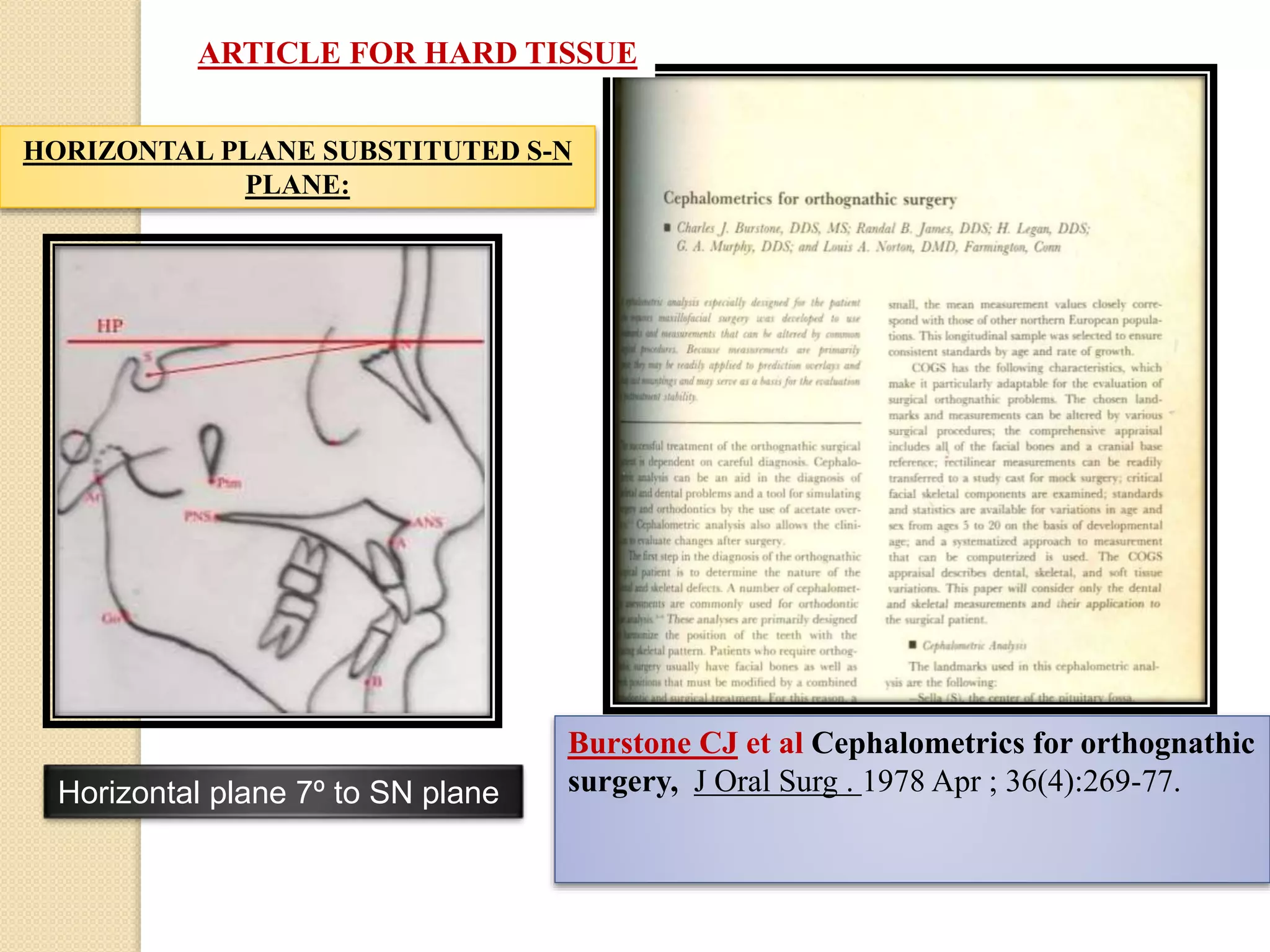 BURSTONE ANALYSIS : C.O.G.S (SOFT TISSUE) | PPTX