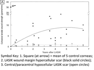 Cohesive tensile strength of human lasik wounds | PPT