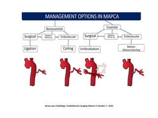 Coiling of Major Aortopulmonary Collateral Arteries (MAPCAs.pptx