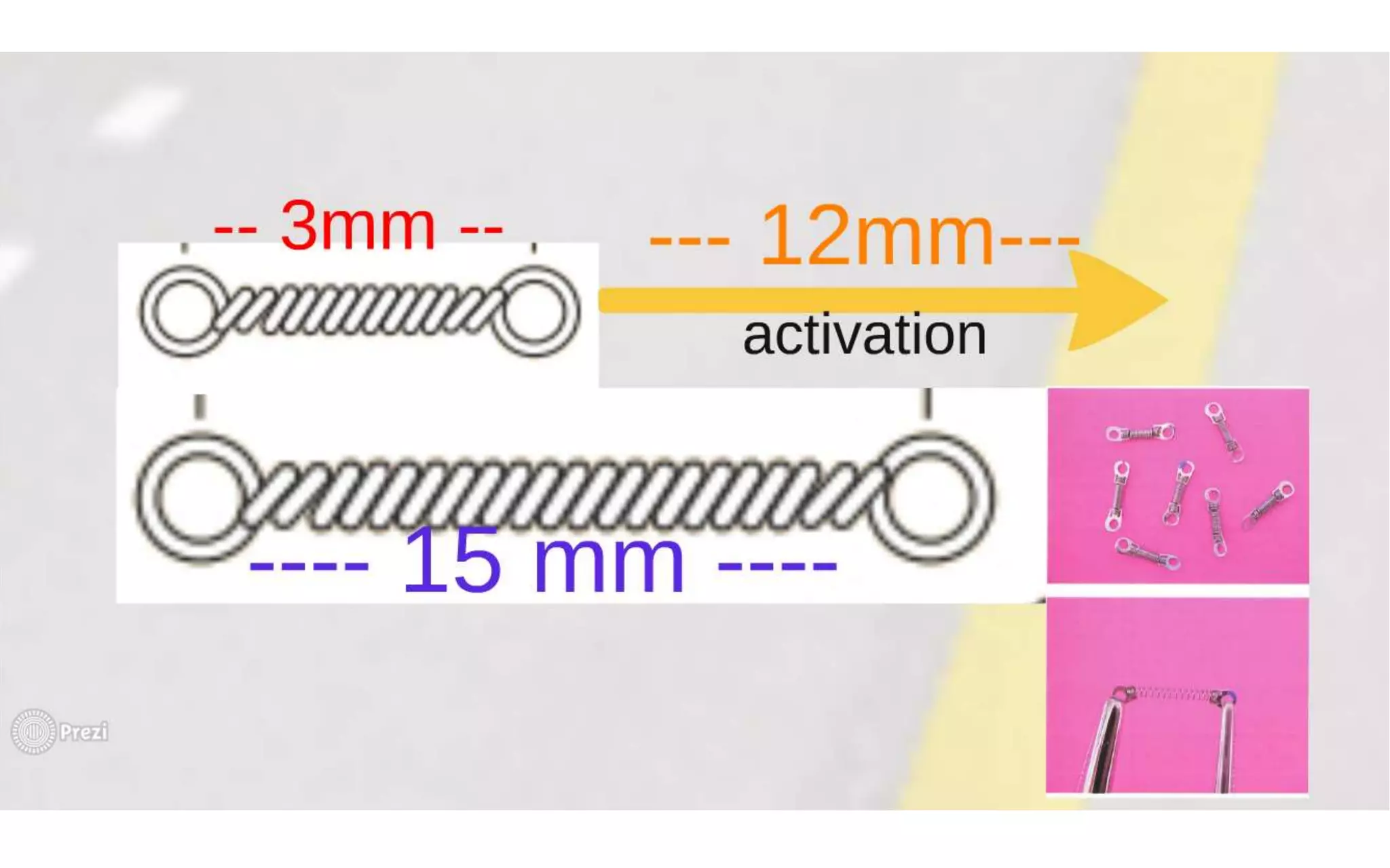 Orthodontic Coil spring | PPTX