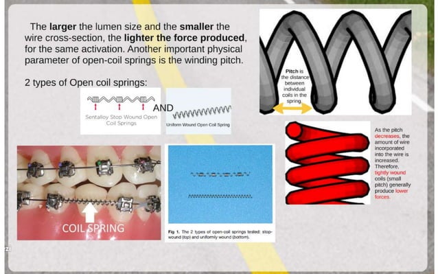 Orthodontic Coil spring | PPT