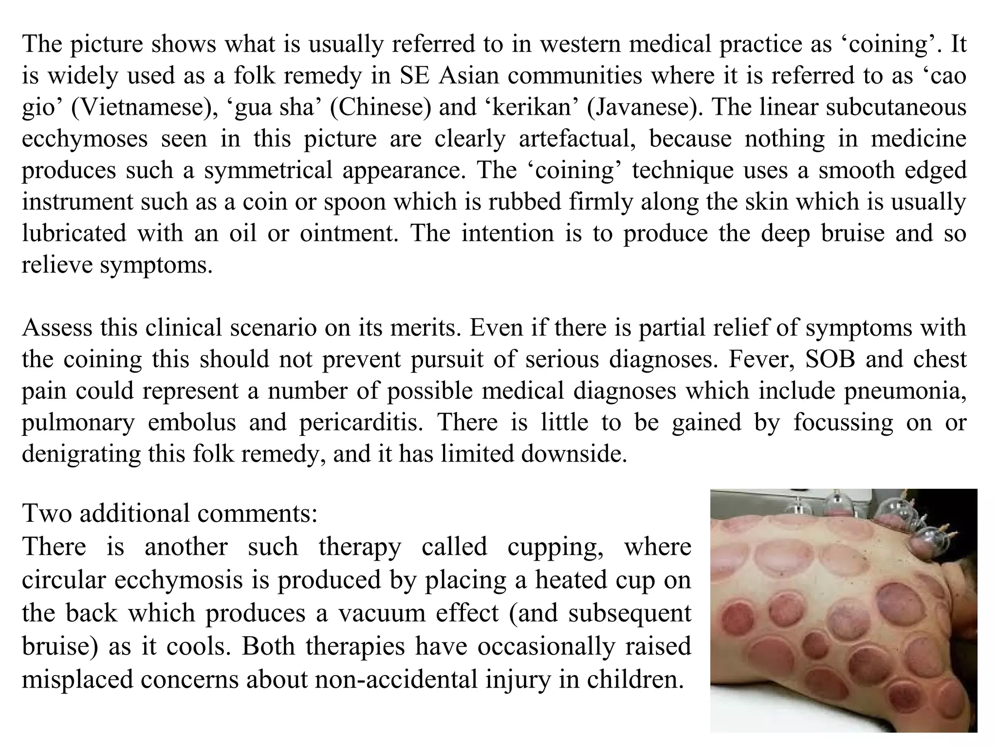 Coining therapy | PPT