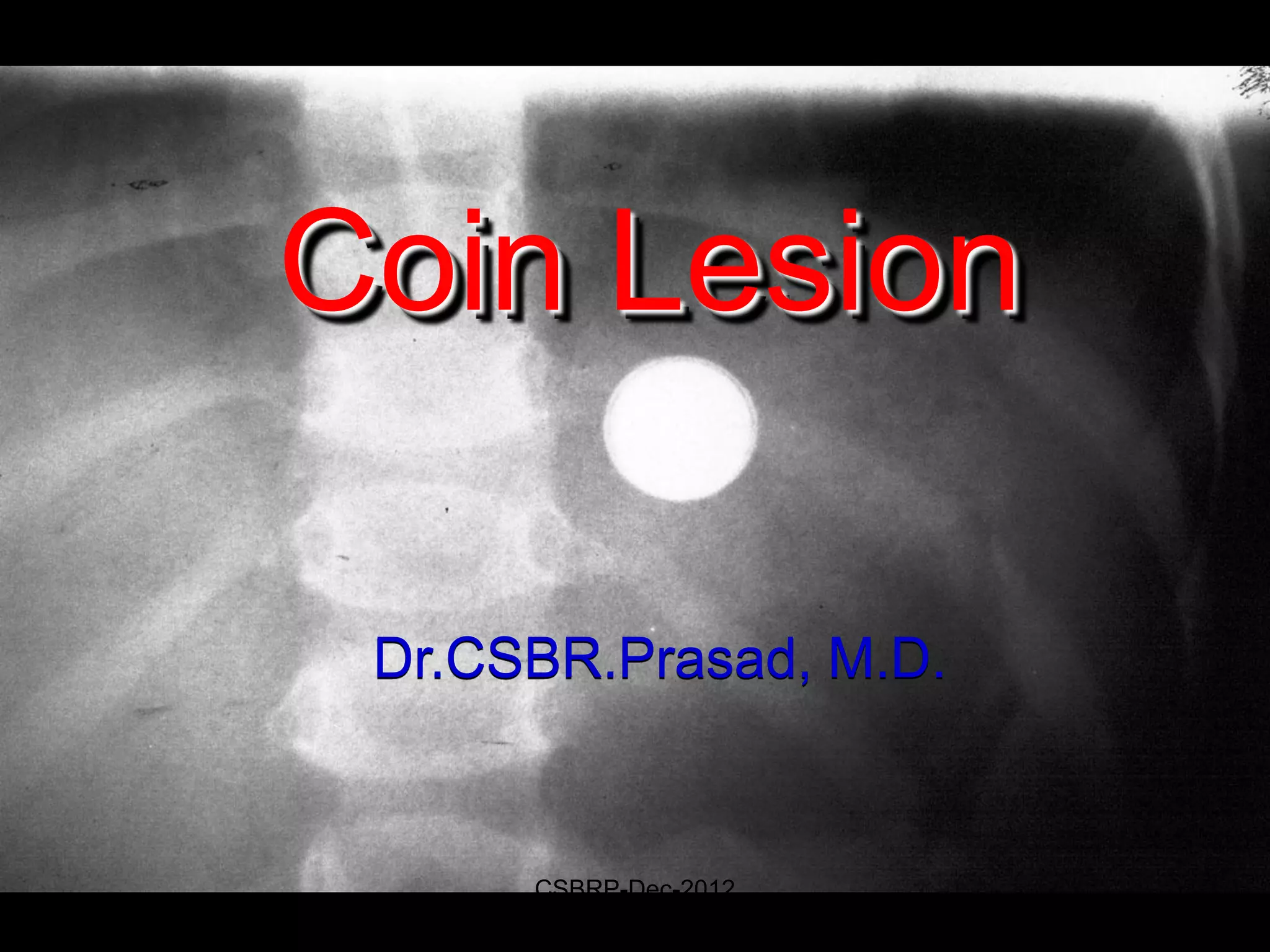 Coin lesion | PDF